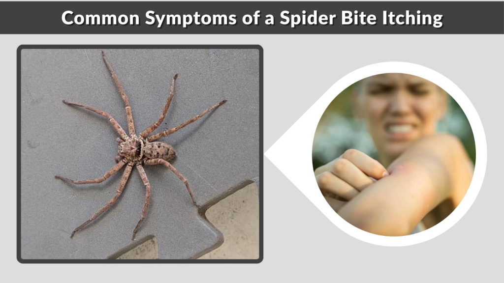 9 Common Symptoms of a Spider Bite: Identification with Pictures