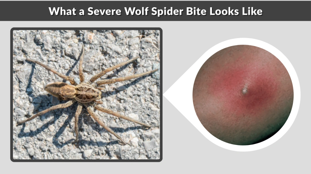 What Does a Wolf Spider Bite Look Like?