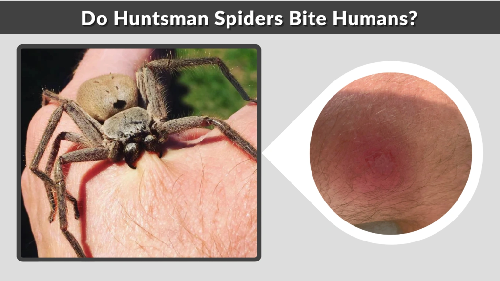 Huntsman Spider Bite: Symptoms, Treatment, and What to Expect