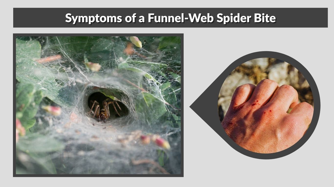 Funnel-Web Spider Bite: Symptoms, Treatment & Prevention