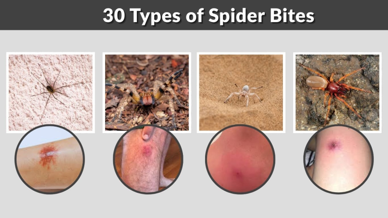30 Types of Spider Bites: Symptoms, Risks & Treatment Guide