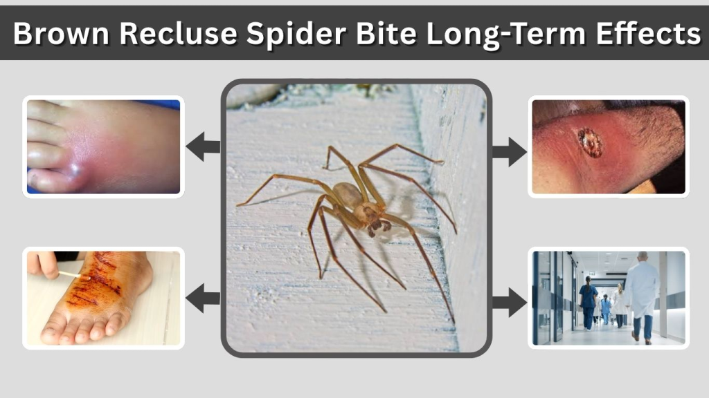 Brown Recluse Spider Bite Long-Term Effects: Symptoms, Side Effects ...